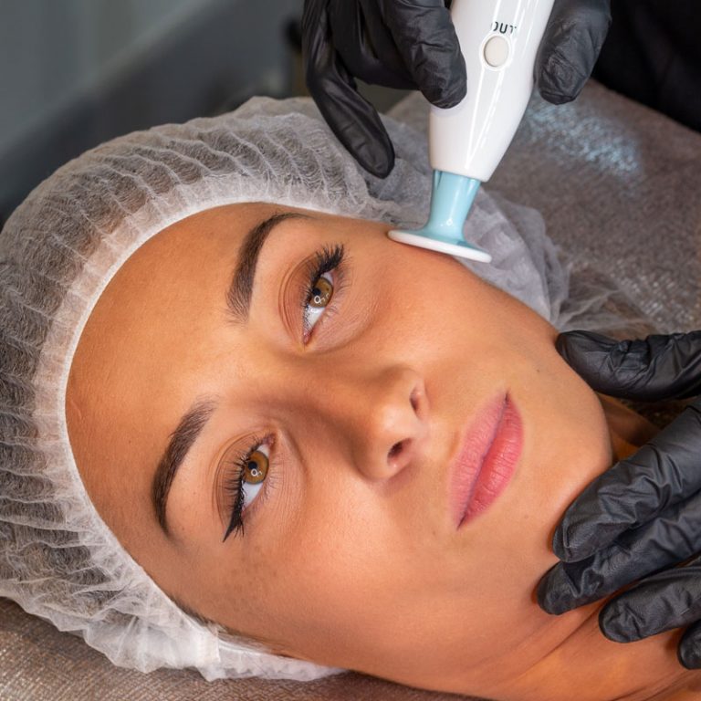 Plasma pen ozone, plasma froid - Beauty Formation